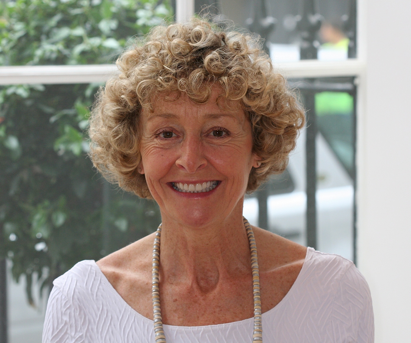 CASE WEB 30 CROWNS AND VENEERS TO TREAT WORN CHIPPED TEETH - The Oliver ...